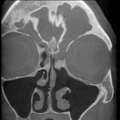 Institut für Digitale Volumentomographie DVT - Leitung Prof. Dr ...